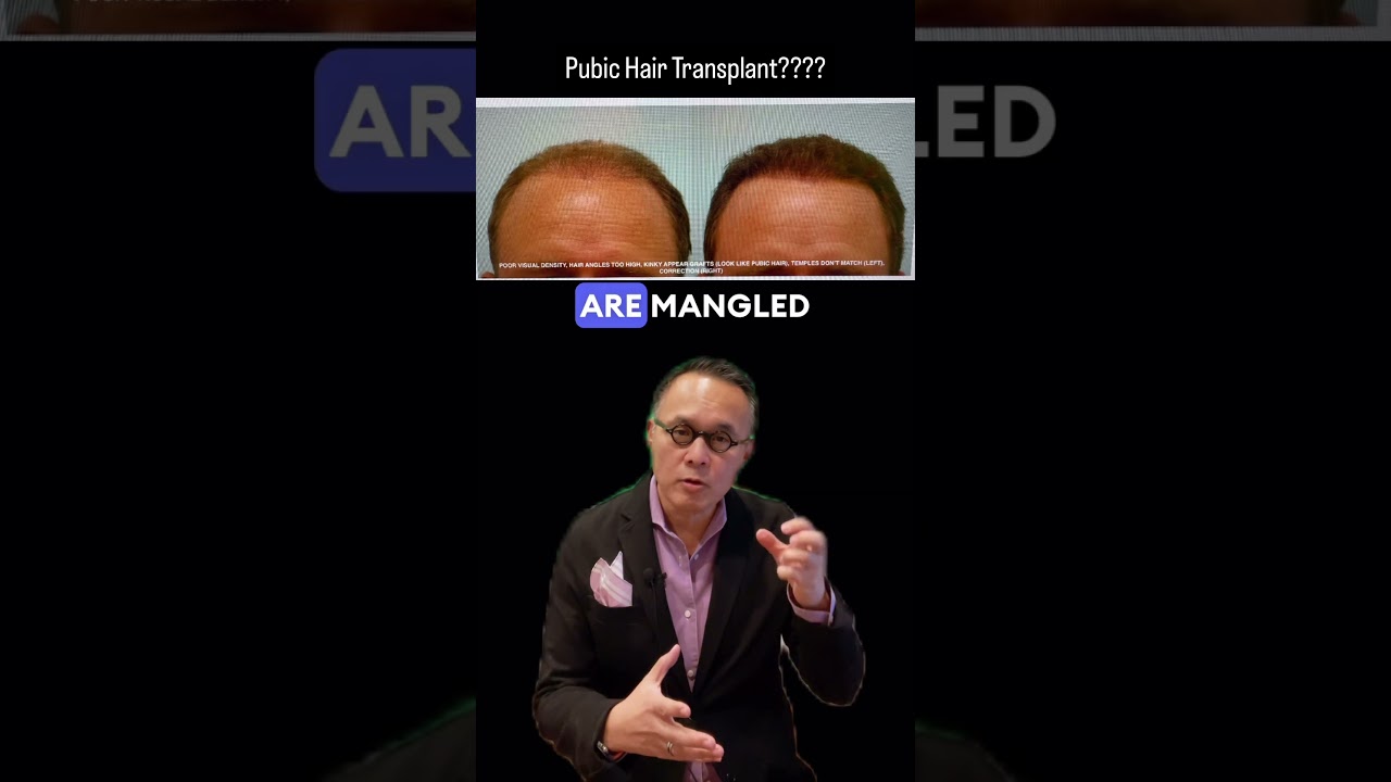 Pubic Hair Transplant???