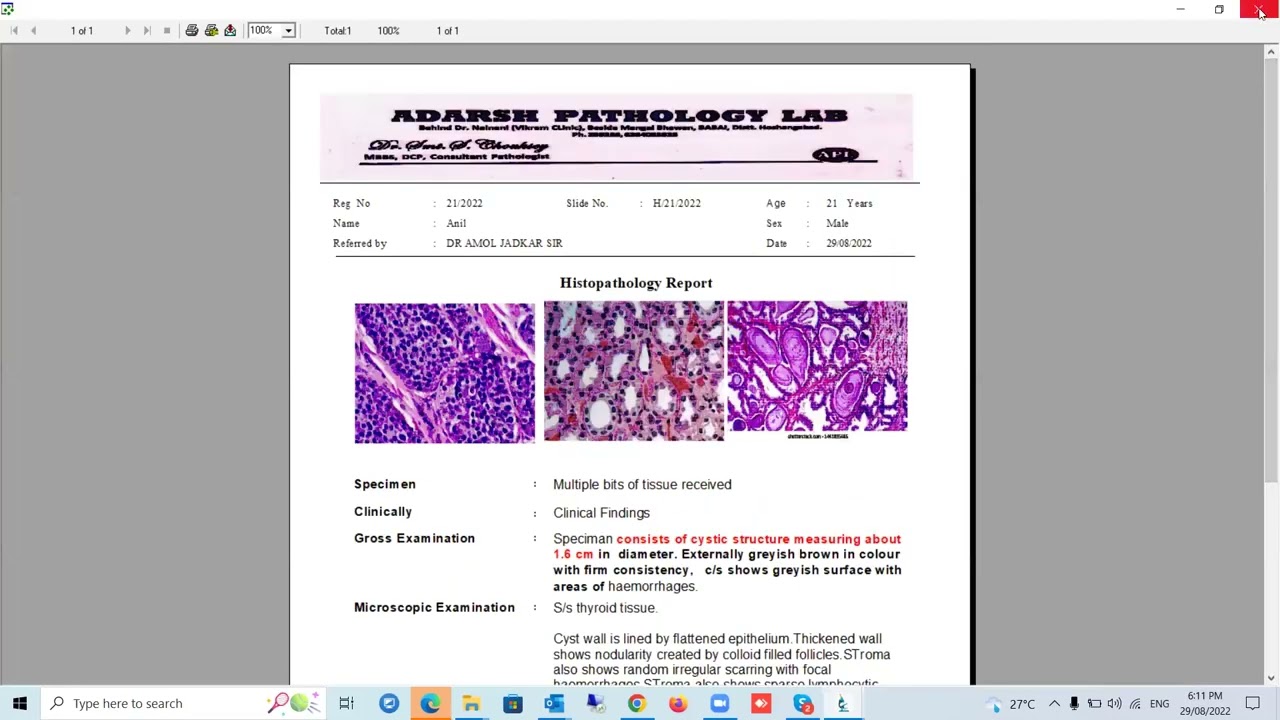 PathoGold Extension Studio Plus (PESP), Laboratory Management Software with HISTOPATH module.