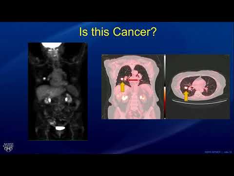 Molecular Imaging for the Detection of Cancer