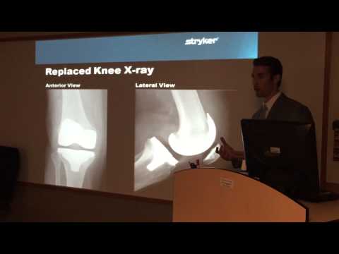 Knee Surgery as a Treatment Option for Knee Pain