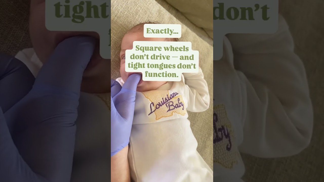 Tongue Ties: Fallacy or Function? The Truth No One’s Saying