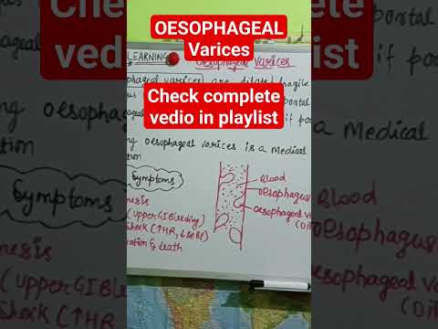 OESOPHAGEAL VARICES