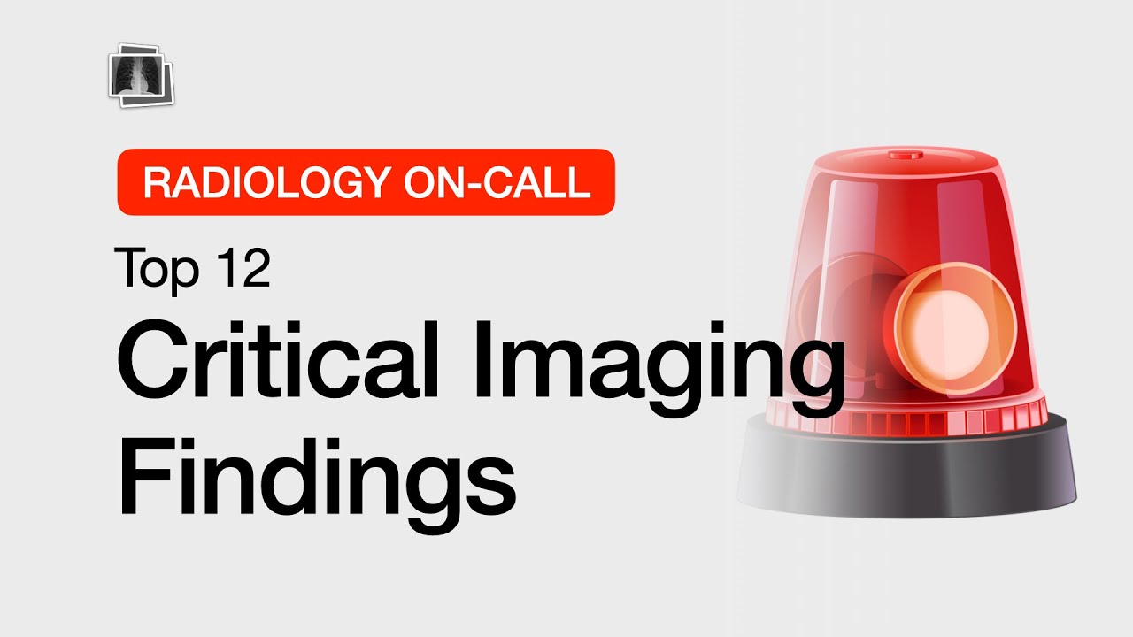 Top 12 Critical Imaging Findings | Radiology On-Call