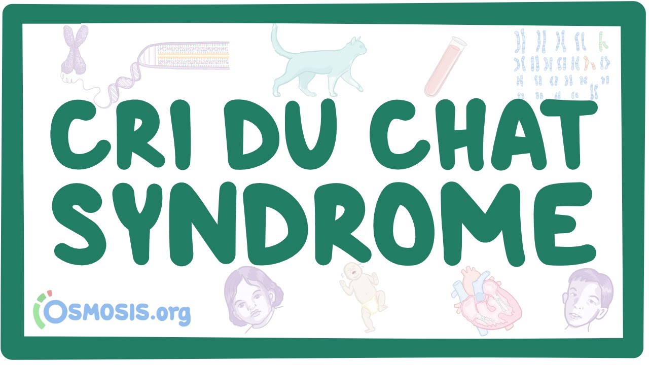 Cri du chat syndrome - causes, symptoms, diagnosis, treatment, pathology