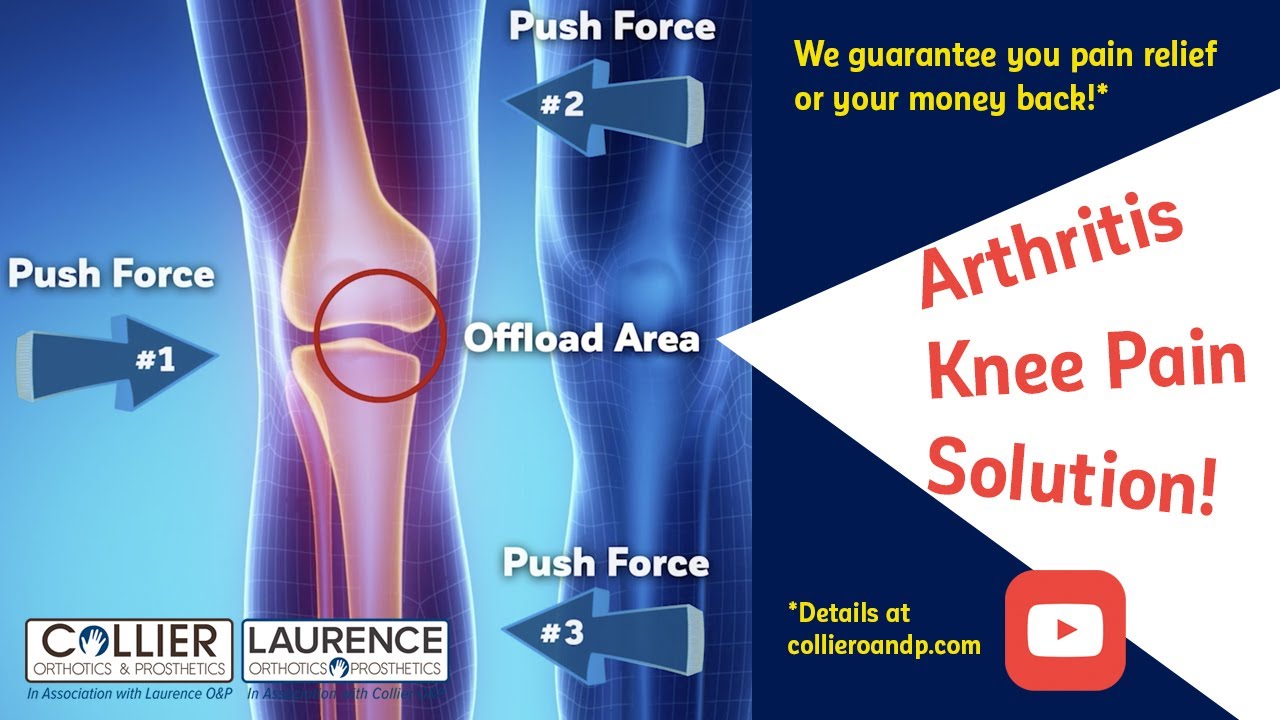 OA Knee Pain How an unloader knee brace works