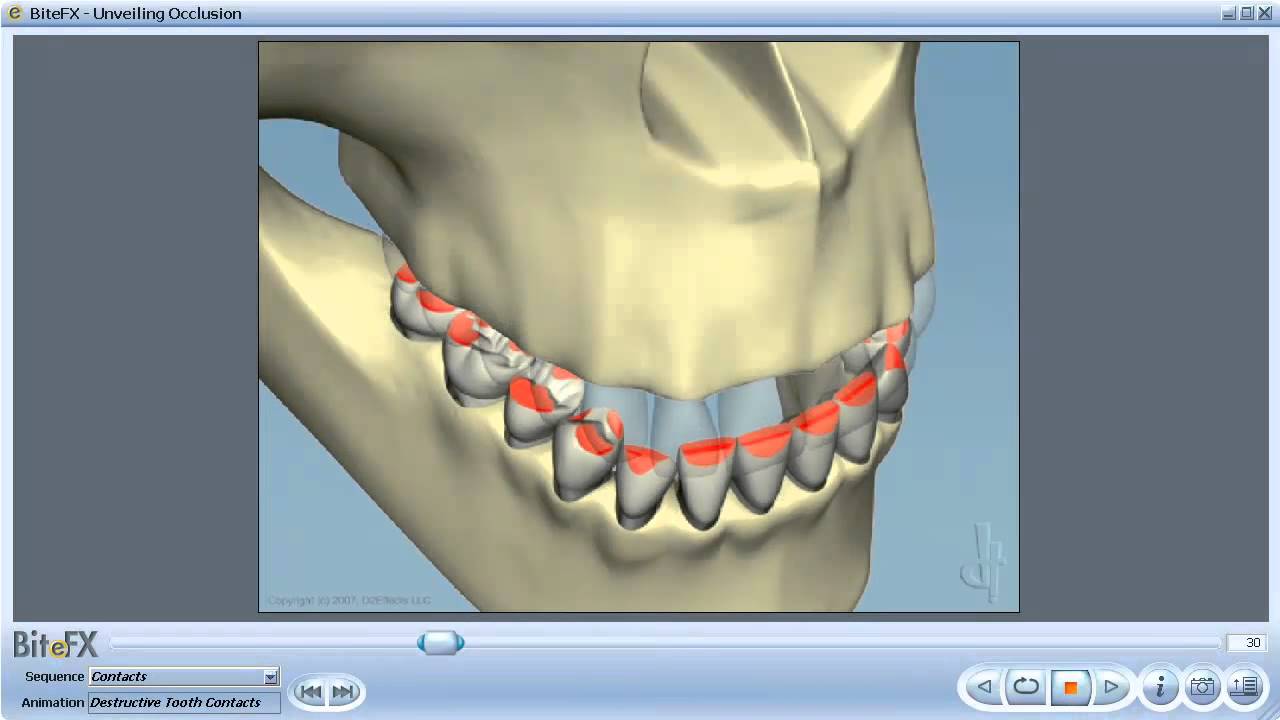 Dental Occlusion