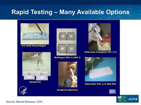 HIV Testing