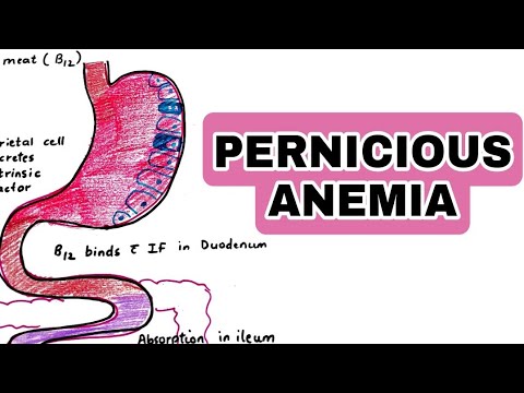 Pernicious anemia | Explained in hindi | Vitamin b12 deficiency anemia