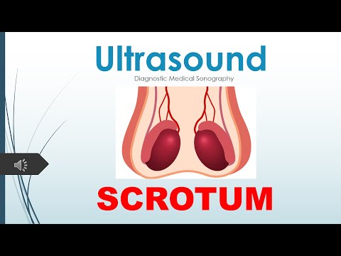 Ultrasound TESTICLES & SCROTUM - Anatomy, physiology, DMS flashcards, multiple-choice questions
