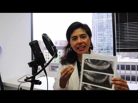 How Accutane Can Affect Your Eye and Health - The Eye Show