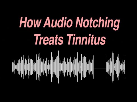 How Audio Notching Treats Tinnitus