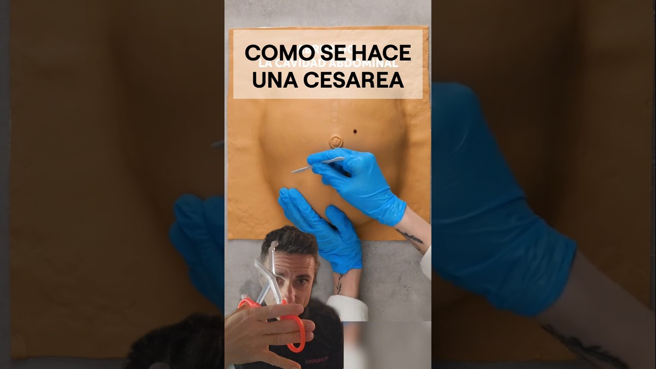 How to perform a cesarean section. #survival #didyouknow #funfacts