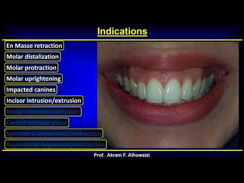 TADs 2018 Part 4 Indications (English)