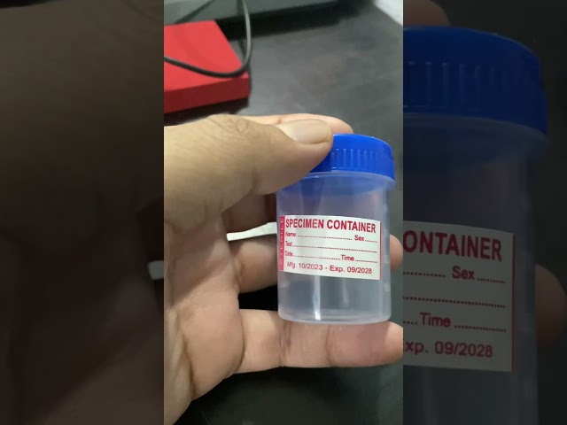 Disposable Urine Container - Pp Sample Container 50Ml Manufacturer from ...