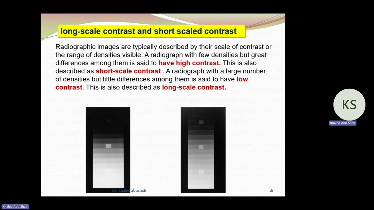Understanding Density and Contrast in Radiology: Key Concepts for 2024 ...