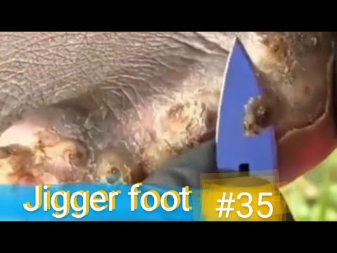 Jigger foot #satisfyingvideo