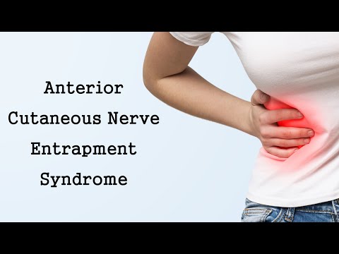 Anterior Cutaneous Nerve Entrapment Syndrome