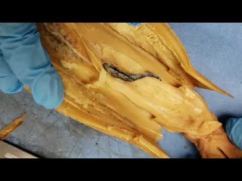 Squid dissection | ink sac