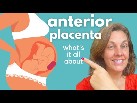 Anterior Placenta Challenges and Risks
