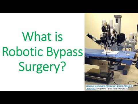 What is robotic bypass surgery?