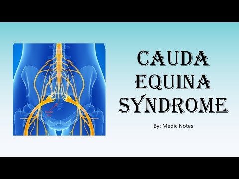 [Ortho] Cauda equina syndrome - definition, causes, treatment