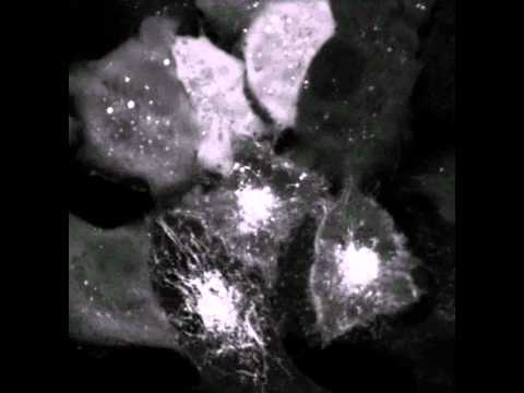 Matrix Protein 2 of Influenza A Virus Blocks Autophagosome Fusion with Lysosomes