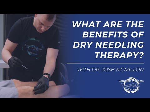 The Benefits Of Dry Needling: With Doctor Josh McMillon