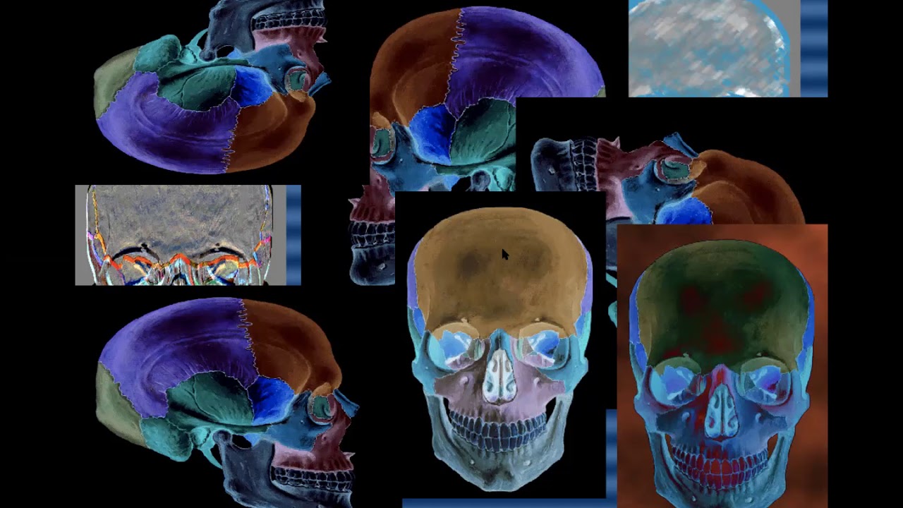 Huesos del Craneo Parte 1 UCV