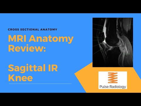 MRI Knee Sagittal IR Anatomy in under 60 Seconds