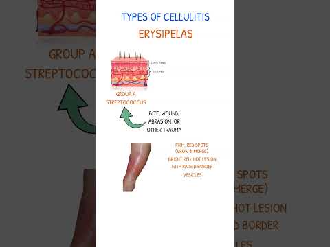 CELLULITIS ERYSIPELAS