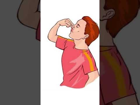 Epistaxis management