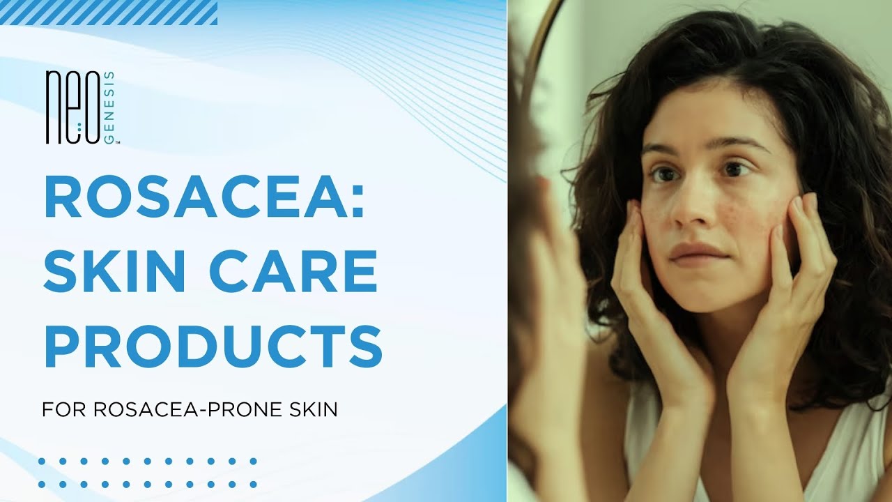 Rosacea: Skin Care Products for Rosacea-Prone Skin
