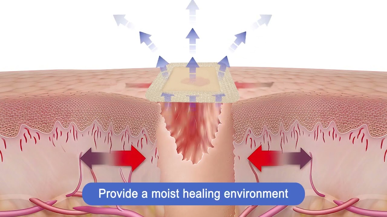 Ceeport Silicone Foam Dressing