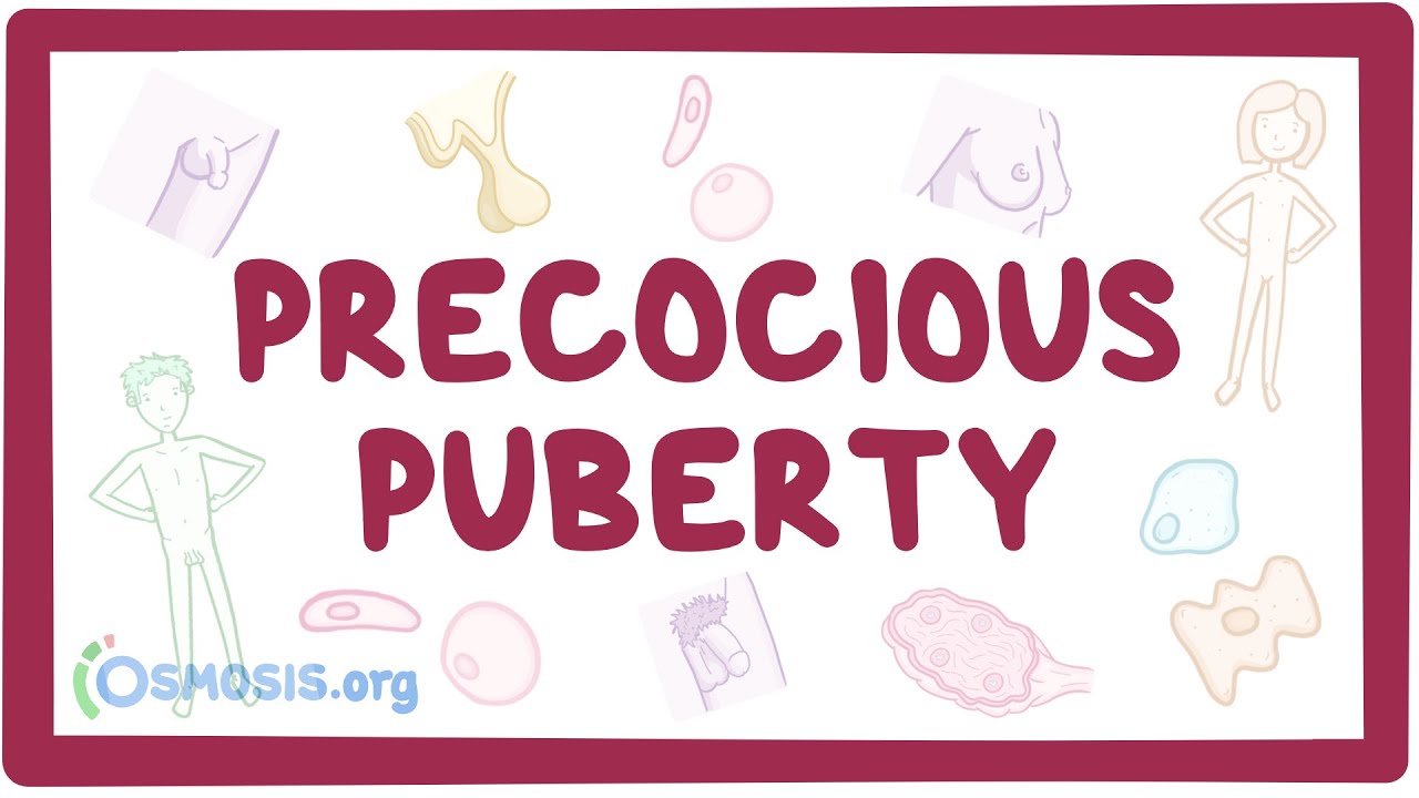 Precocious puberty (Year of the Zebra)