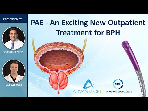 PAE A New Treatment For BPH-Webinar