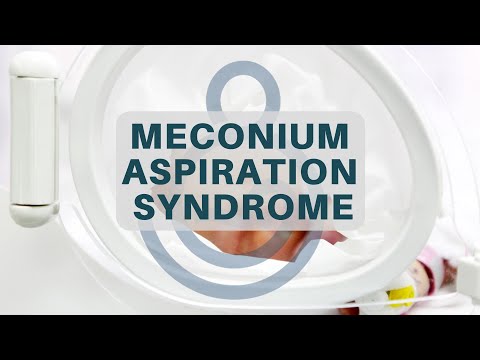 Meconium Aspiration Syndrome
