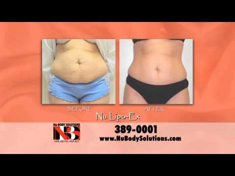 NuBody Nu Lipo-Ex Ad
