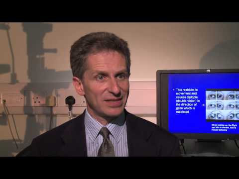 Thyroid Eye Disease - Thyroid Treatment