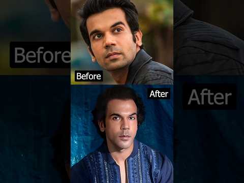 Do you think RajKumar Roa has undergone Chin Implant surgery?