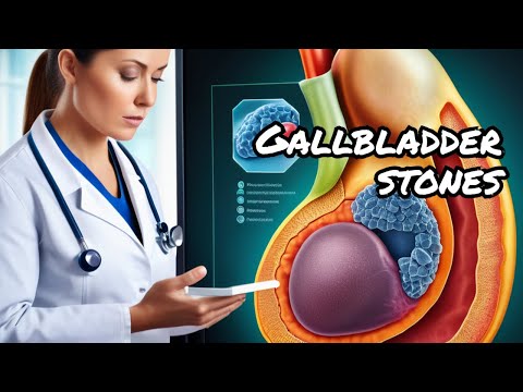 Gallbladder stones causes symptoms diagnosis treatment prevention and complications