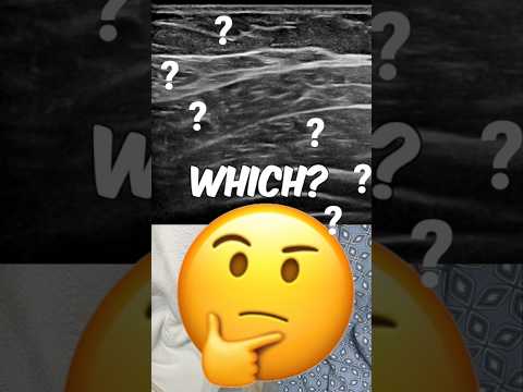 Top TAP tip! Trouble identifying layers? Try this trick… #nerveblock #pain #ultrasound #fascial