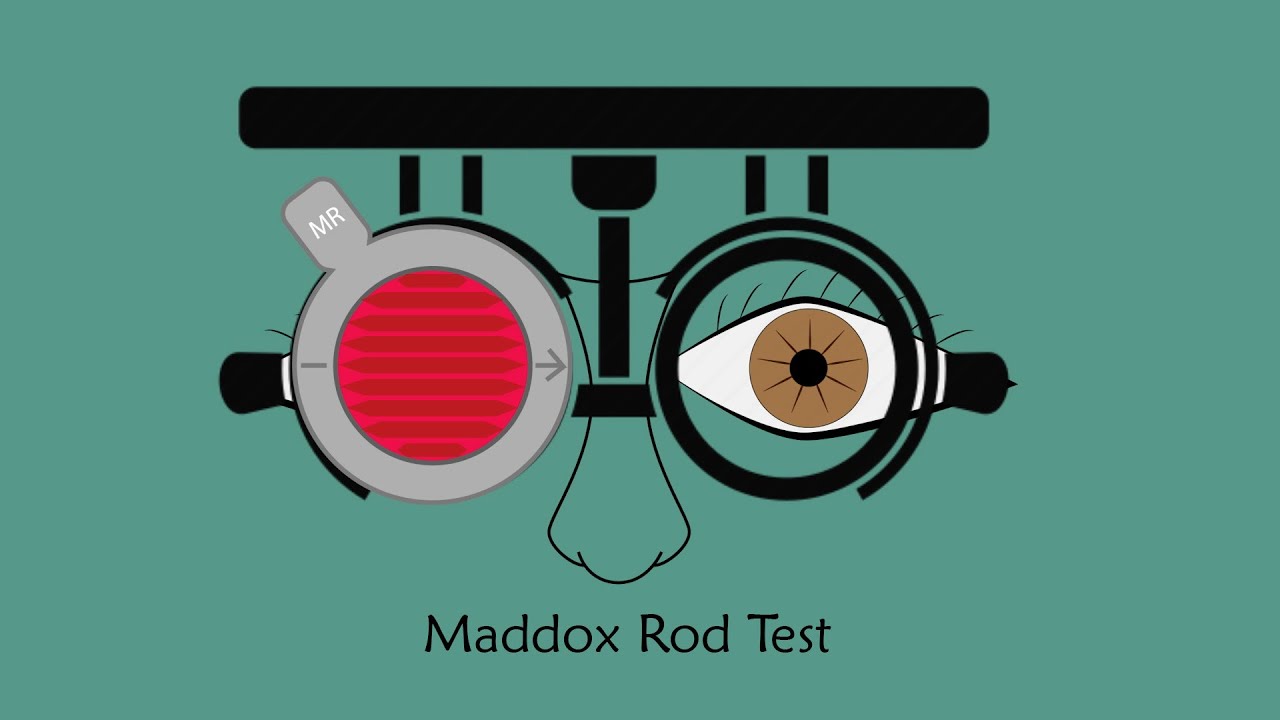 Maddox Rod Test