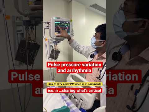 #icushort 32: Pulse pressure variation and arrhythmia