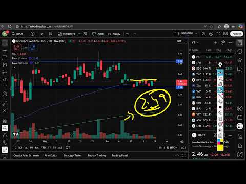 MBOT Stock (Microbot Medical stock analysis) MBOT STOCK PREDICTION MBOT STOCK analysis MBOT stock