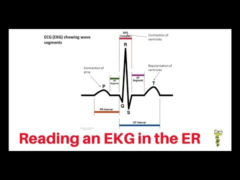How to quickly read an EKG in the emergency department