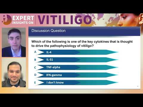 Expert Insights on Vitiligo
