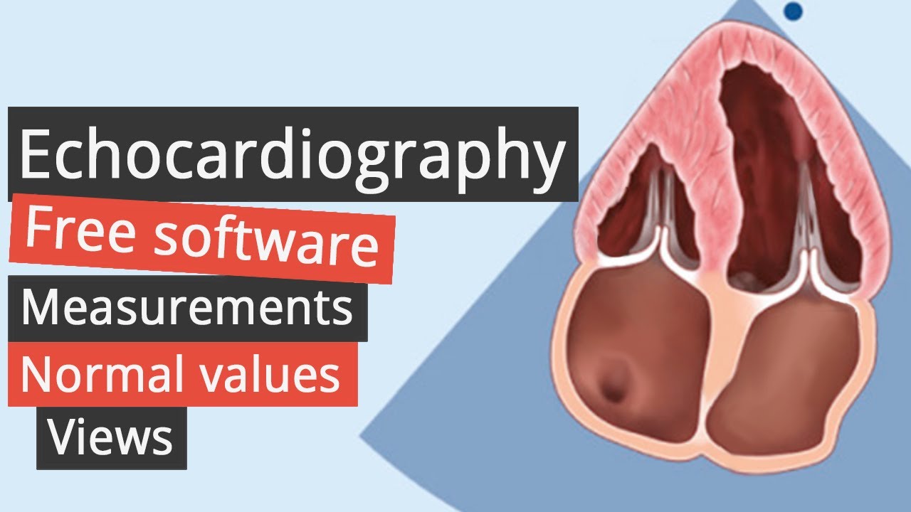 Echocardiography (Free software)