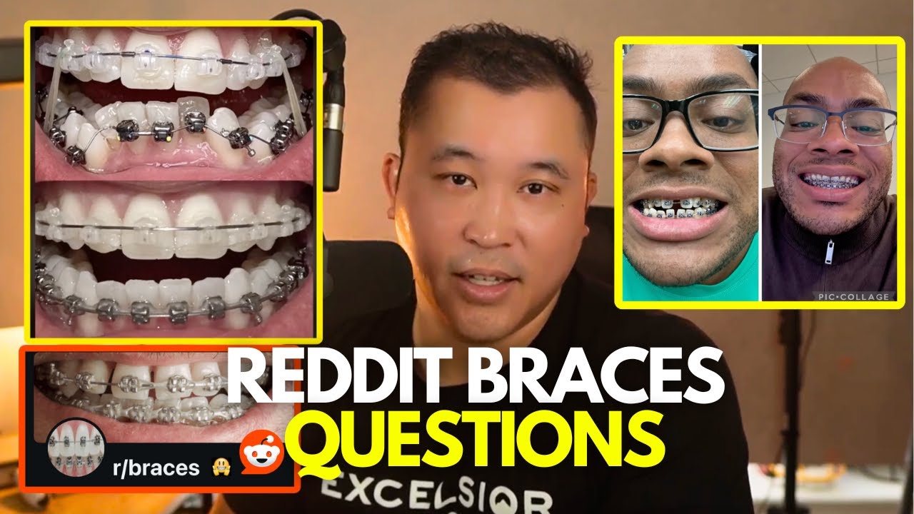 24 Minutes of Honest Orthodontist Reactions to r/Braces (Reddit)