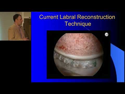 Brian J. White, MD, Orthopedic Hip Specialist