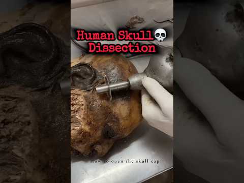 Human Skull Dissection #shorts #ytshorts #viralshorts